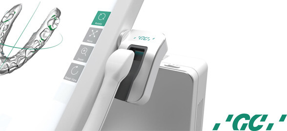 Comparison of intraoral scans: Which one is best for your dental ...
