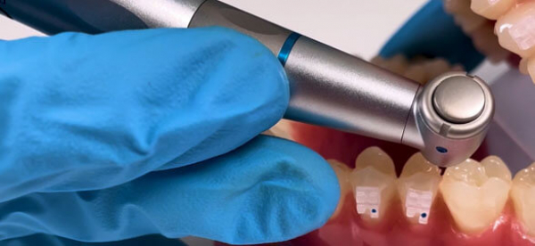 Dental contra-angles: A comprehensive guide to understanding how they work and choosing the ...