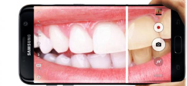 Dental Photography, tricks with a mobile - Dental Supplies and ...