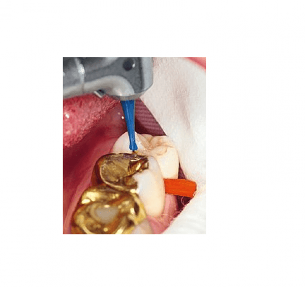 PolyBur P1 polymer bur for CA (10pcs) - KOMET