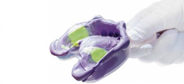 Polyether vs Silicones - Exact and precise impressions Which one to ...