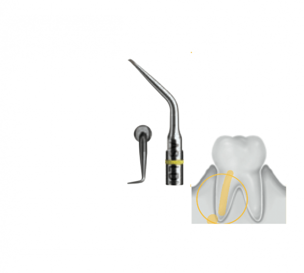ASLD ultrasonic insert left angulation for apical surgery (1pc.) - SATELEC