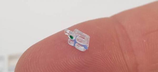 Sapphire braces and the evolution of orthodontics - Dental Supplies and ...