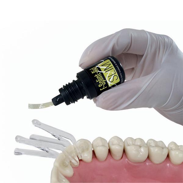 Periodontal Splinting Kit: F-Splint Aid + Slim+ Application Tweezers ...
