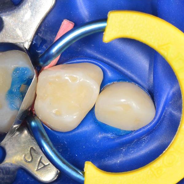 Omni: Prosthetic Brush orange - Polydentia