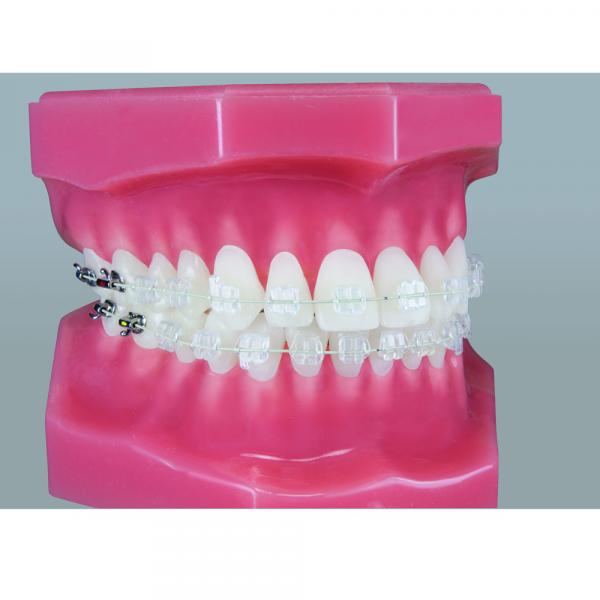 Typodont with Pure Sapphire Brackets - ORTHO TECHNOLOGY