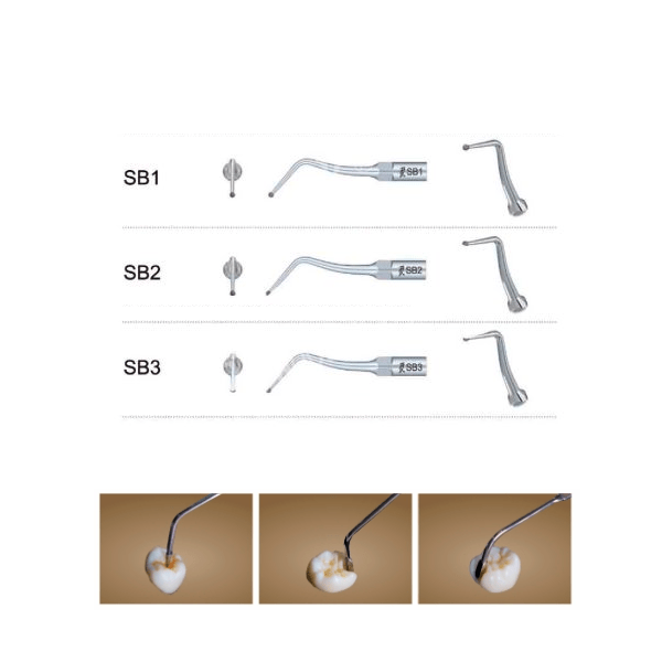 Ultrasonic tips SB Preparation cavities for EMS - WOODPECKER