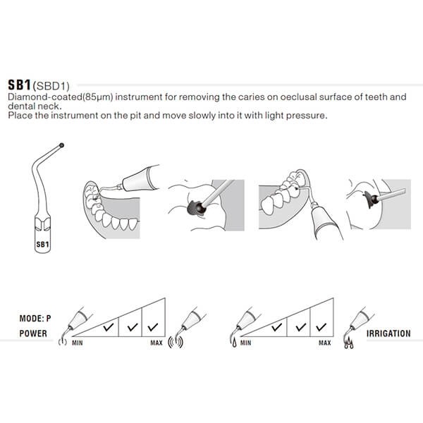 Ultrasonic tips SB Preparation cavities for EMS - WOODPECKER