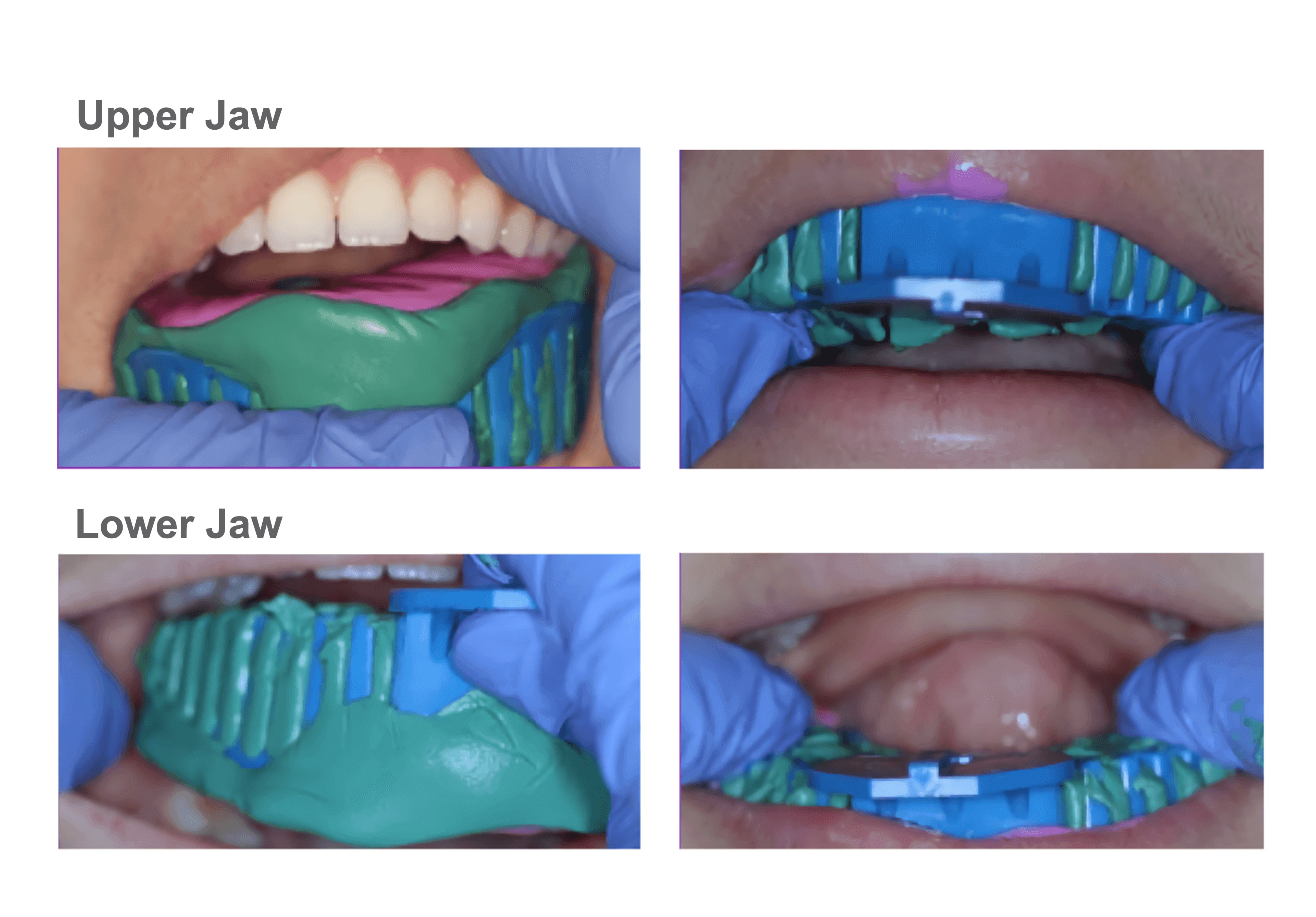 12 Problems We Can Correct To Achieve The Perfect Dental Impression