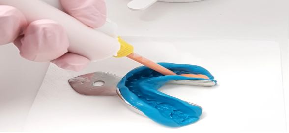 El Blog de Dentaltix Impresión Dental - Dentaltix