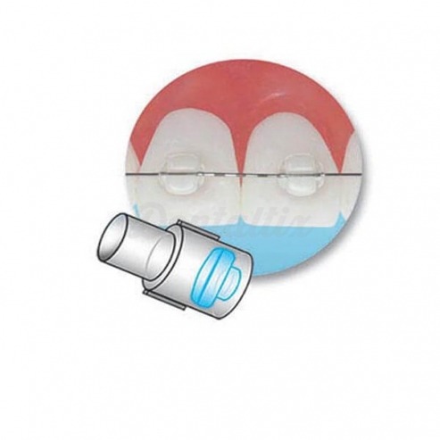 Mini Mold para Bracket de Emergencia Standard ORTHO TECHNOLOGY - Dentaltix