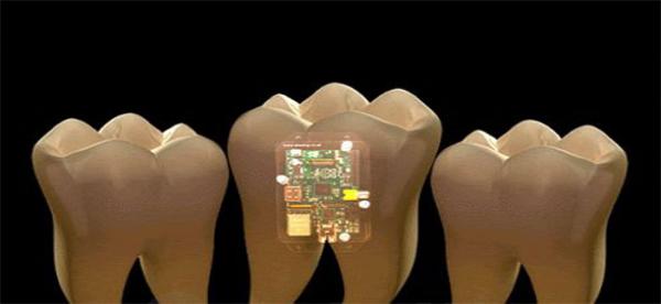 Los chips dentales: ¿para qué sirven y como pueden ayudar a mejorar la ...