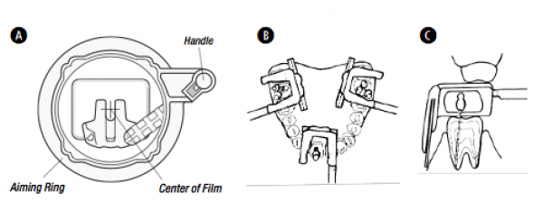 ENDO-RAY POSICIONADOR RADIOGRAFIA RINN - Dentaltix