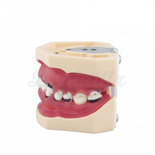 Tipodonto de Periodoncia Completo BADER - Dentaltix