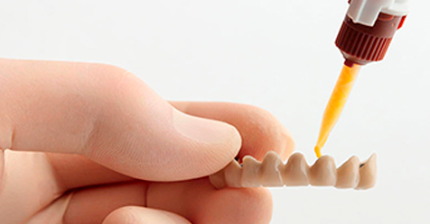 Tout ce que vous devez savoir sur les ciments dentaires (I ...