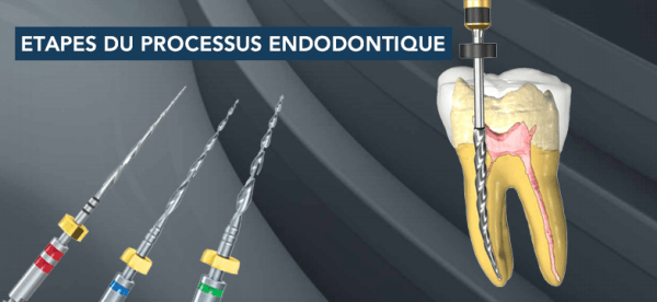 Les produits pour chaque étape du traitement endodontique ...