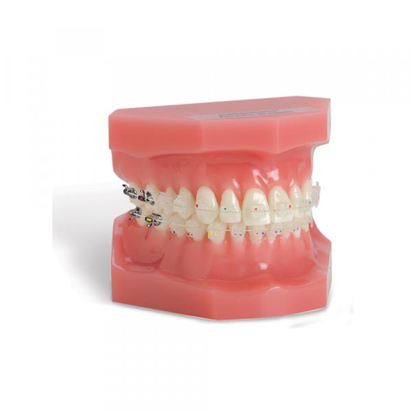 Tipodonto con Brackets Cerámici Riflettente - ORTHO TECHNOLOGY