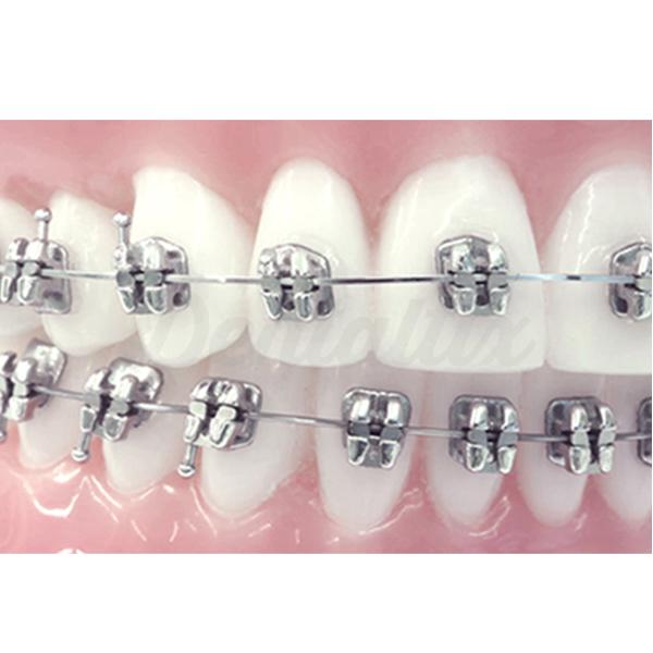 EASYCLIP+: Brackets Auto-Ligantes .022" ADITEK - Dentaltix