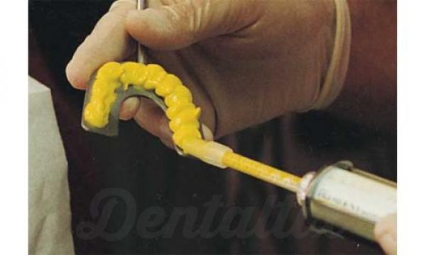 JET BITE SPREADER PONTAS 100u. Coltene - Dentaltix