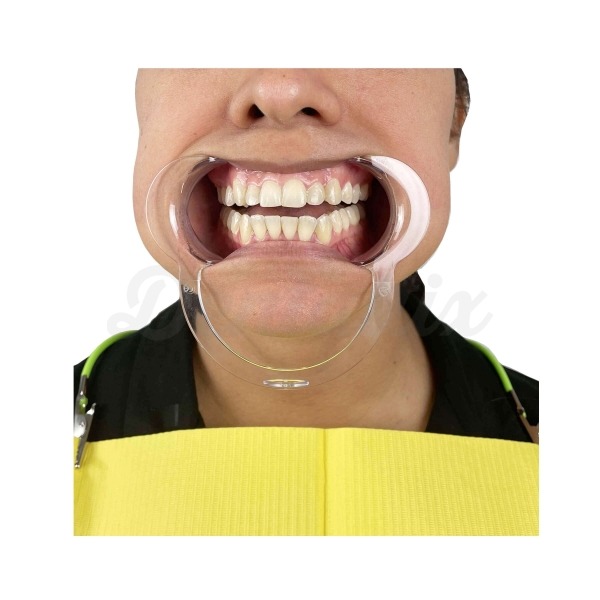 Retractor de Lábios e Bochechas Tipo C (2 pcs) VIDU - Dentaltix