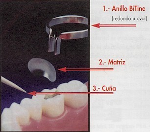 PALODENT Anillos matrices (4ud) Dentsply (Grupo Dentsply Sirona ...