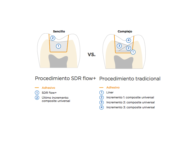 SDR flow+ ECO: Restaurador Bulk Fill Kit universal (50 caps) + REGALO ...